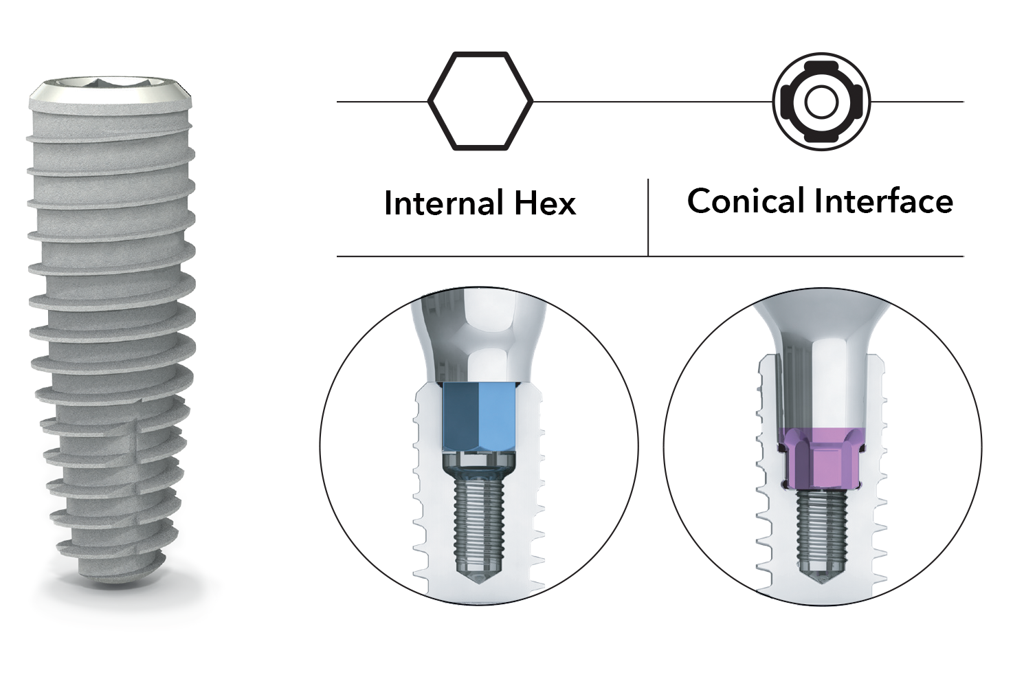 SIC Implants