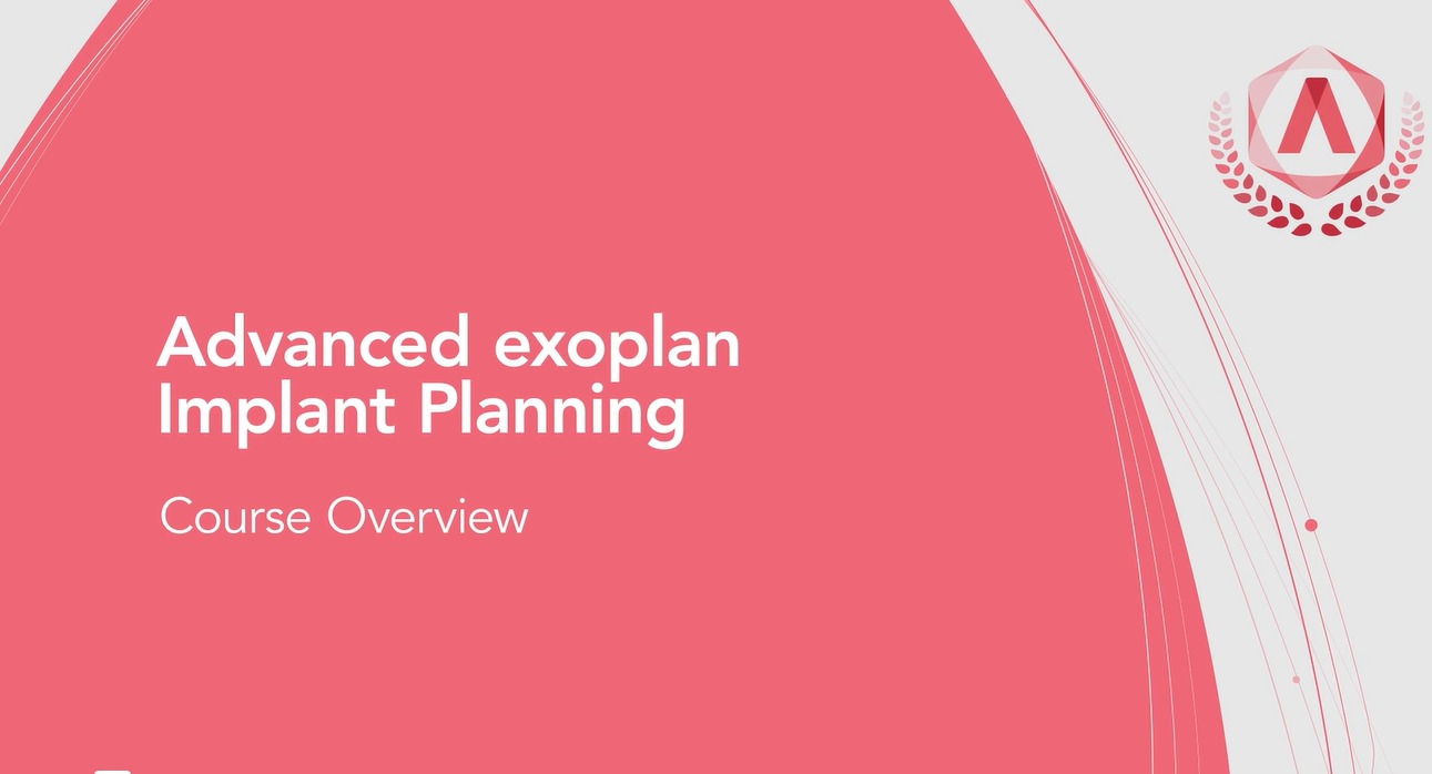 exocad exoplan implant planning and surgical guide design