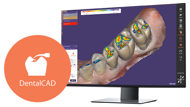 exocad DentalCAD