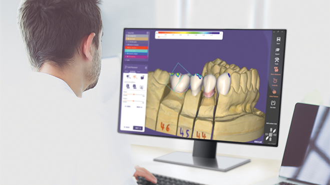 Dental Crown and Bridge Outsourcing with Imagine USA