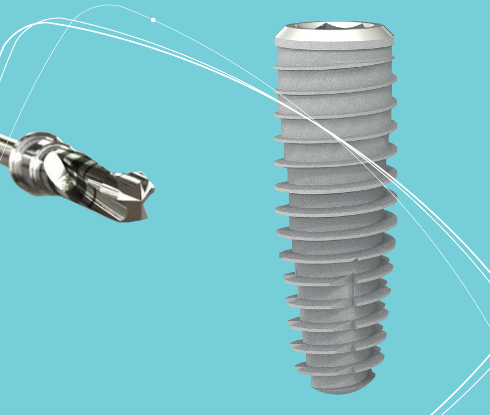 exocad exoplan implant planning and surgical guide design