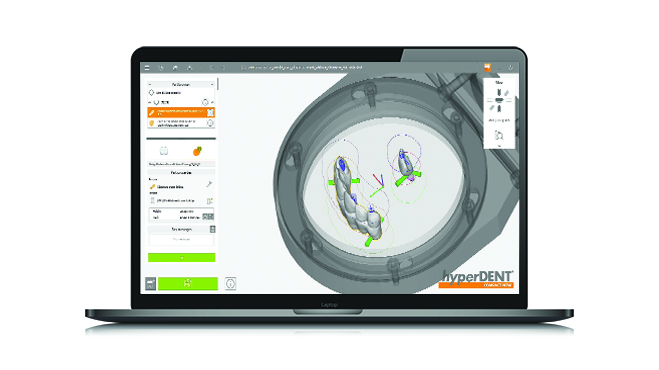 hyperDENT CAM Software